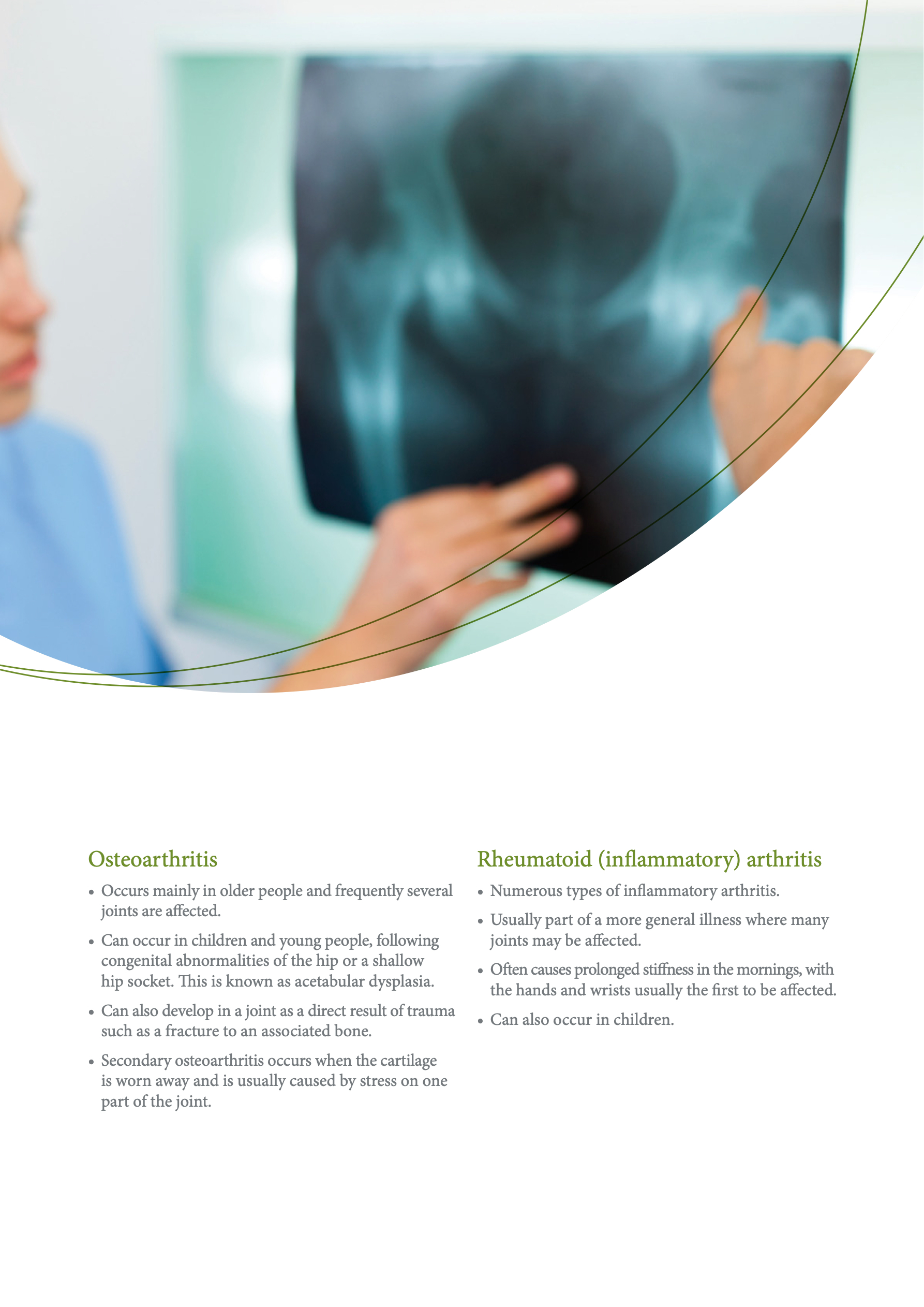 Arthroplasty for Arthritis Brochure